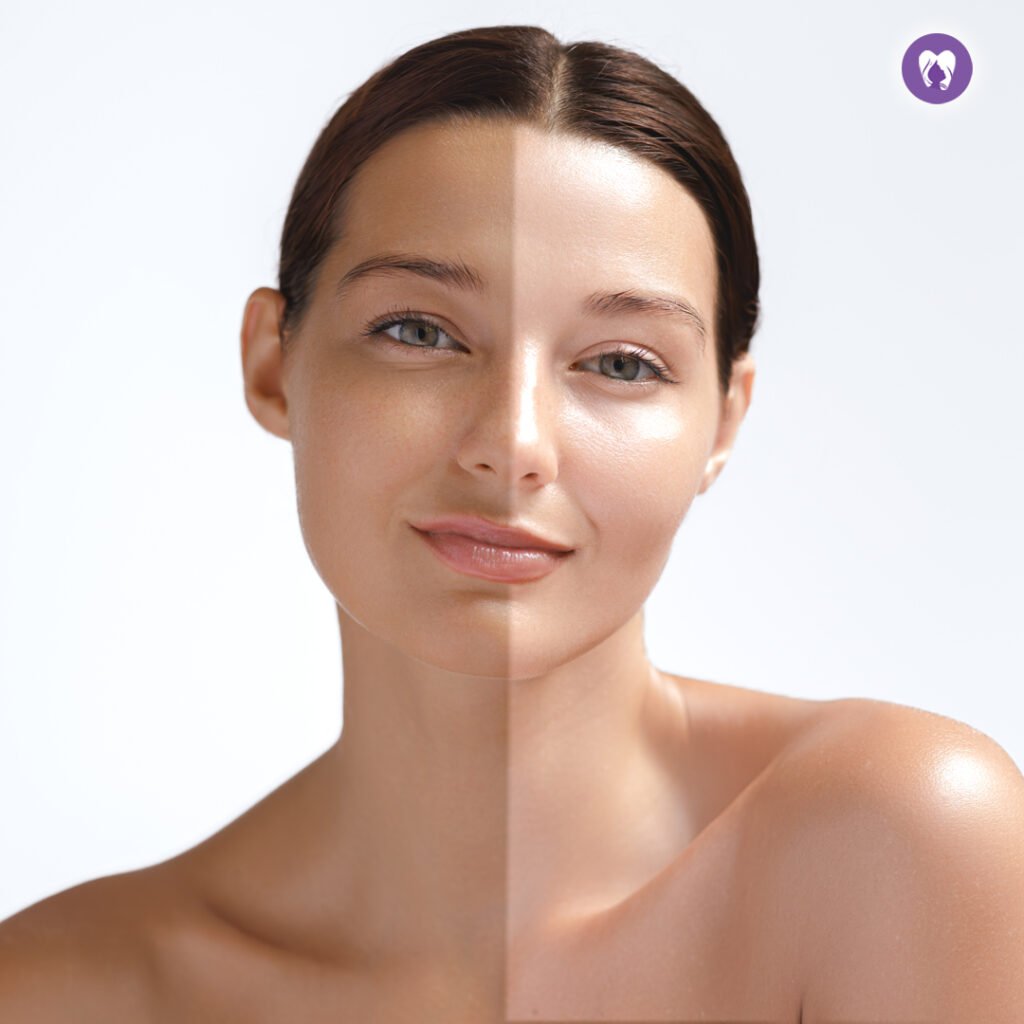 Unlock Your Radiant Beauty: Skin Lightening and Brightening at RootCosmo