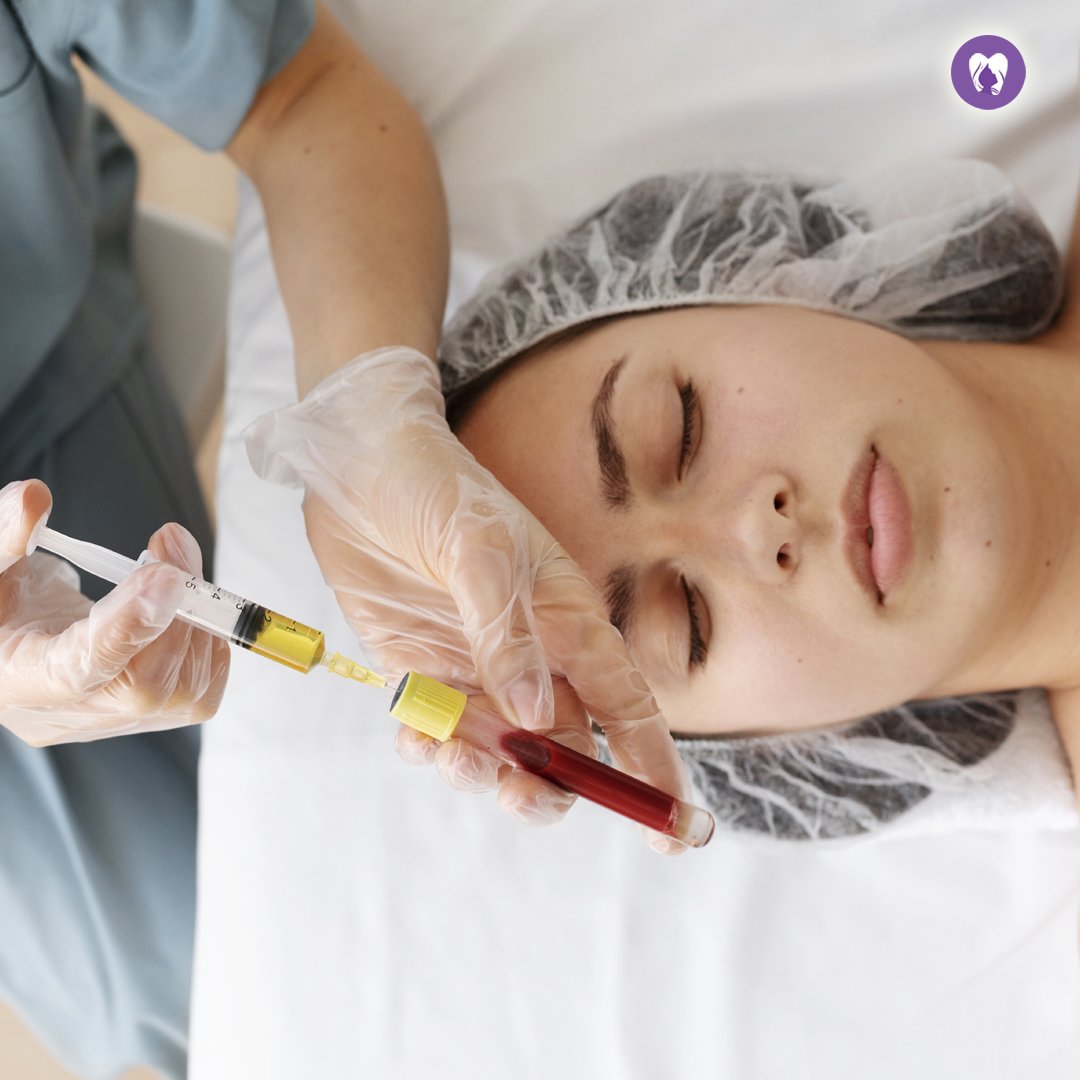 Discover Radiant Skin with Vampire Facial at RootCosmo