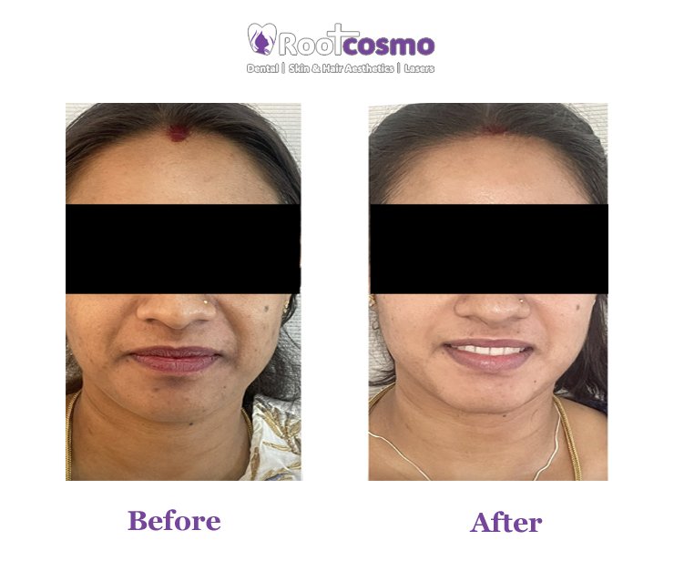 Unlock Your Radiant Beauty: Skin Lightening and Brightening at RootCosmo
